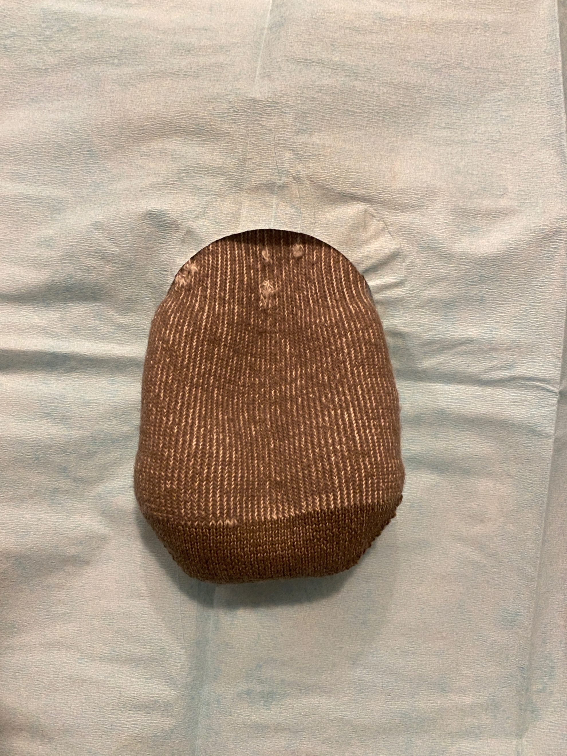 Weissman Model – Vasectomy Resources