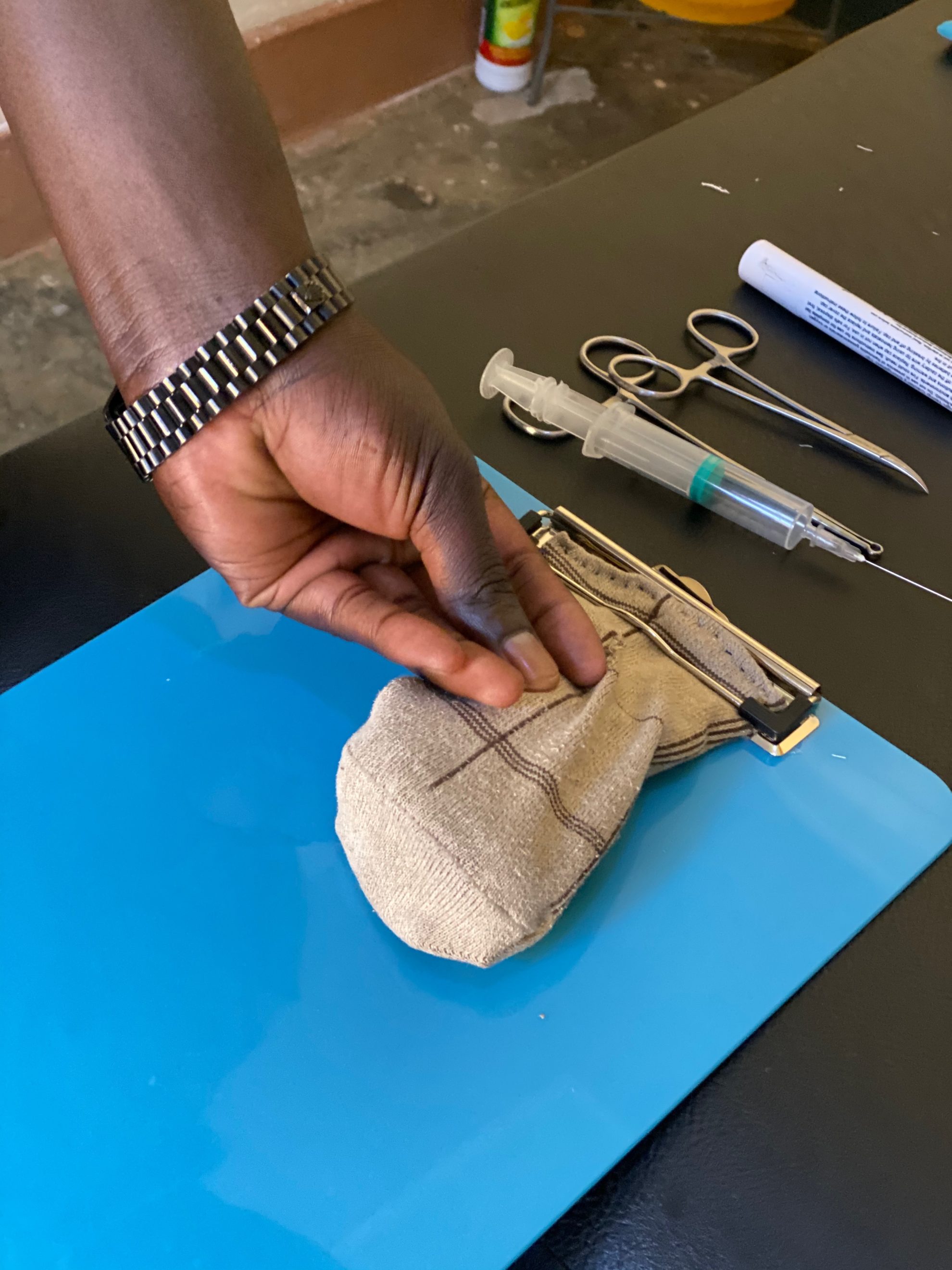 Weissman Model – Vasectomy Resources