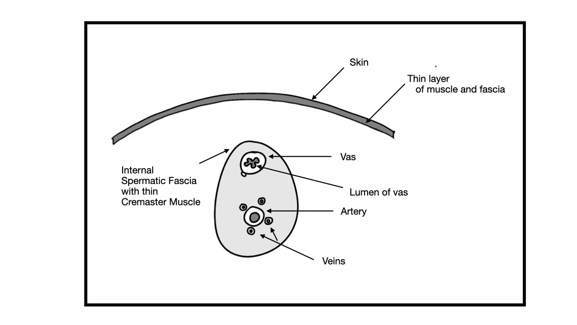 Anatomy for Vasectomy – Vasectomy Resources